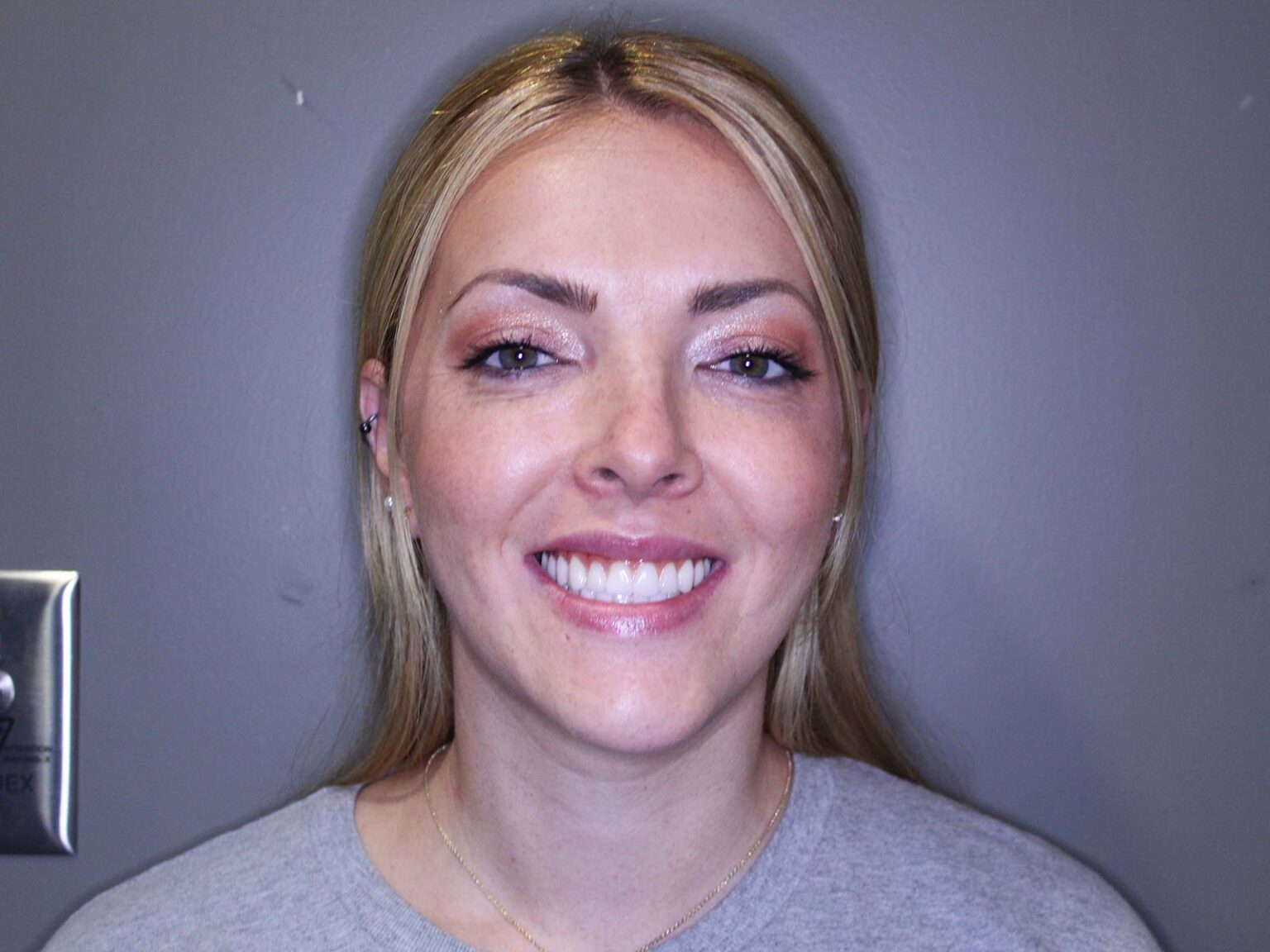 Implants 4 Life: Dental Implants in Sherman Oaks, Santa Clarita, & Chino